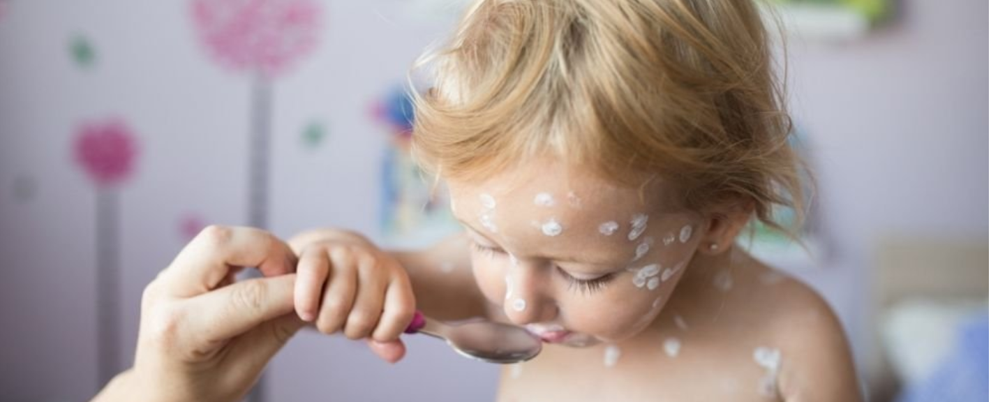 Ovčie kiahne prekonáte aj bez lekára. Ako si poradiť? | Najlekáreň.eu