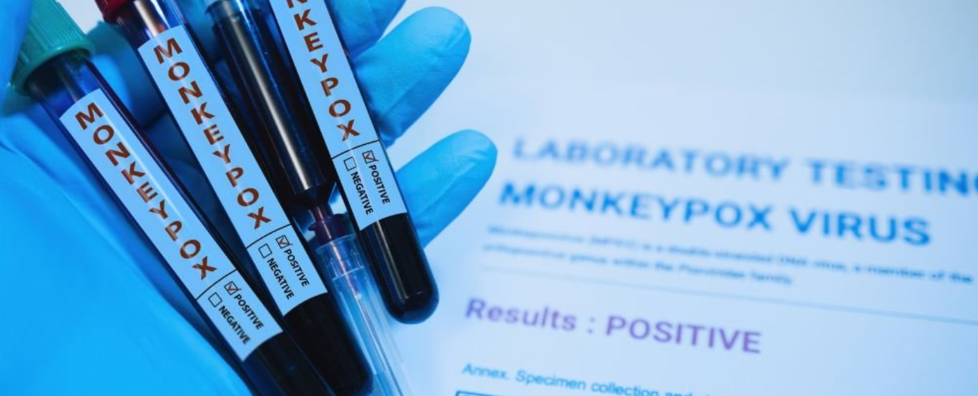 Opičie kiahne. Čo o nich potrebujete vedieť? | Najlekáreň.eu